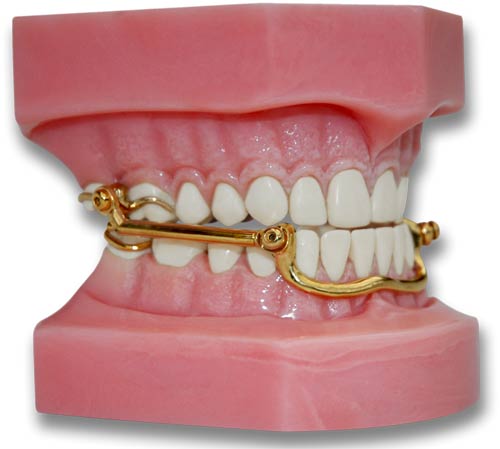 The Best Mandibular Advancement Device for Sleep Apnea and Snoring
